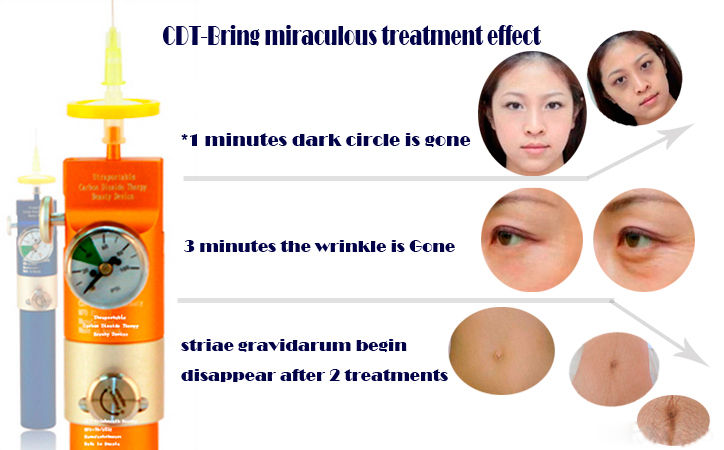 12g Co2 Gas Carboxytherapy Machine, High Quality 12g Co2 Gas ...