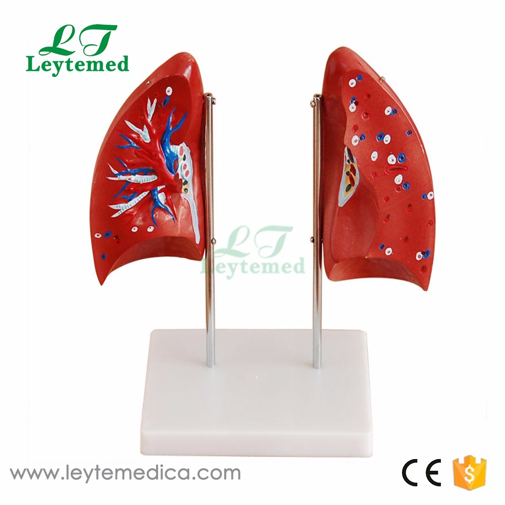 Ltm321 Plastic Anatomical Lung Model For Sale, High Quality Ltm321 ...