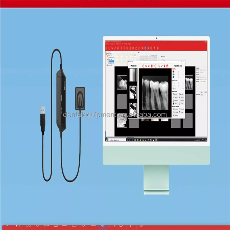 Handy Dental Digital X-ray Sensor Hdr500 Rvg - Usb X Ray Intraoral ...