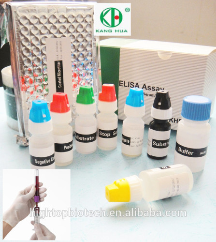 Diagnostic Elisa Reagents, High Quality Diagnostic Elisa Reagents on ...