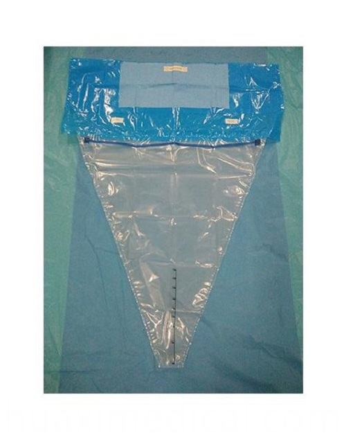 Surgical Drape Underbuttock with Fluid Collection Pouch China Manufacturer