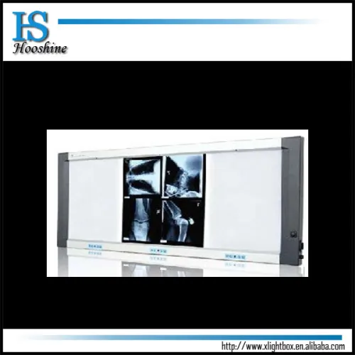 Medical Negatoscope X-ray Film Viewer/x-ray Film Scanner, High Quality ...