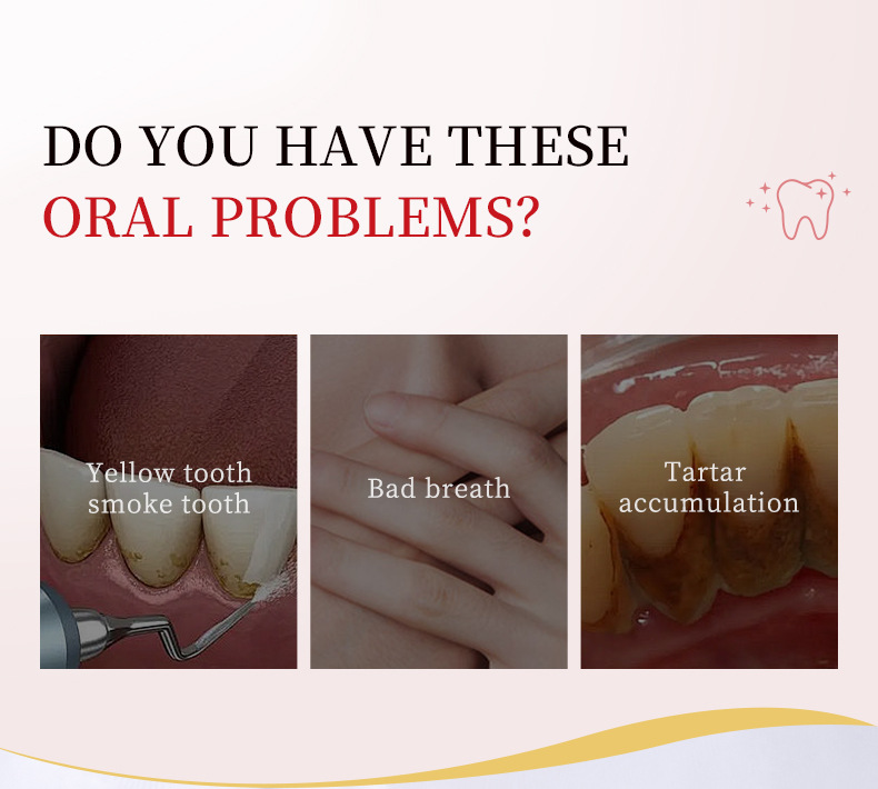 Hunmui Probiotic Whitening Toothpaste: Fresh Breath, Herbal Ingredients ...