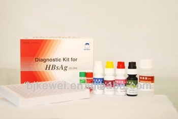 Medical Equipment Hbsag Elisa Test Kit, High Quality Medical Equipment ...