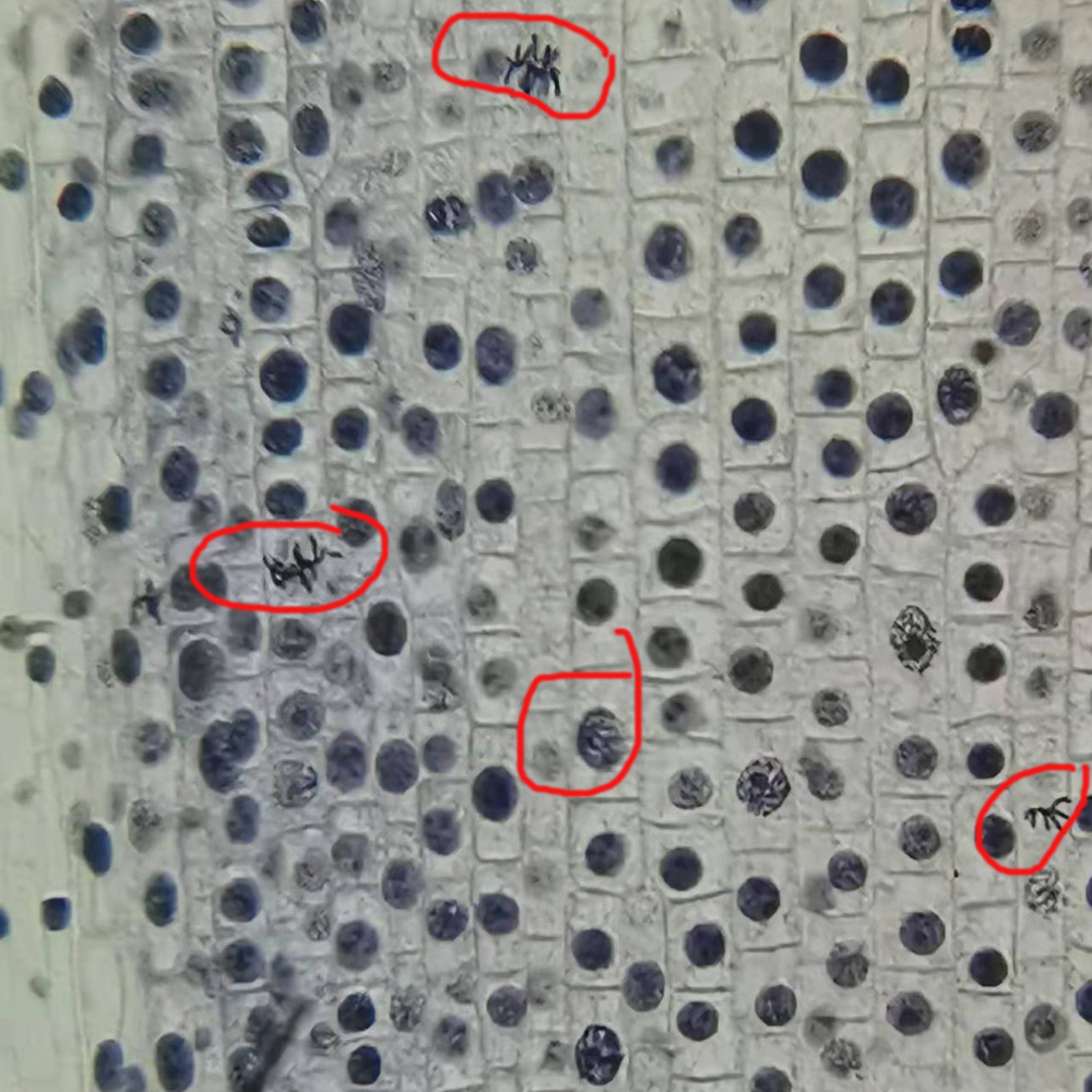Onion Root Tip Mitosis Cell Stages Plant Genetics Biology Microscope ...