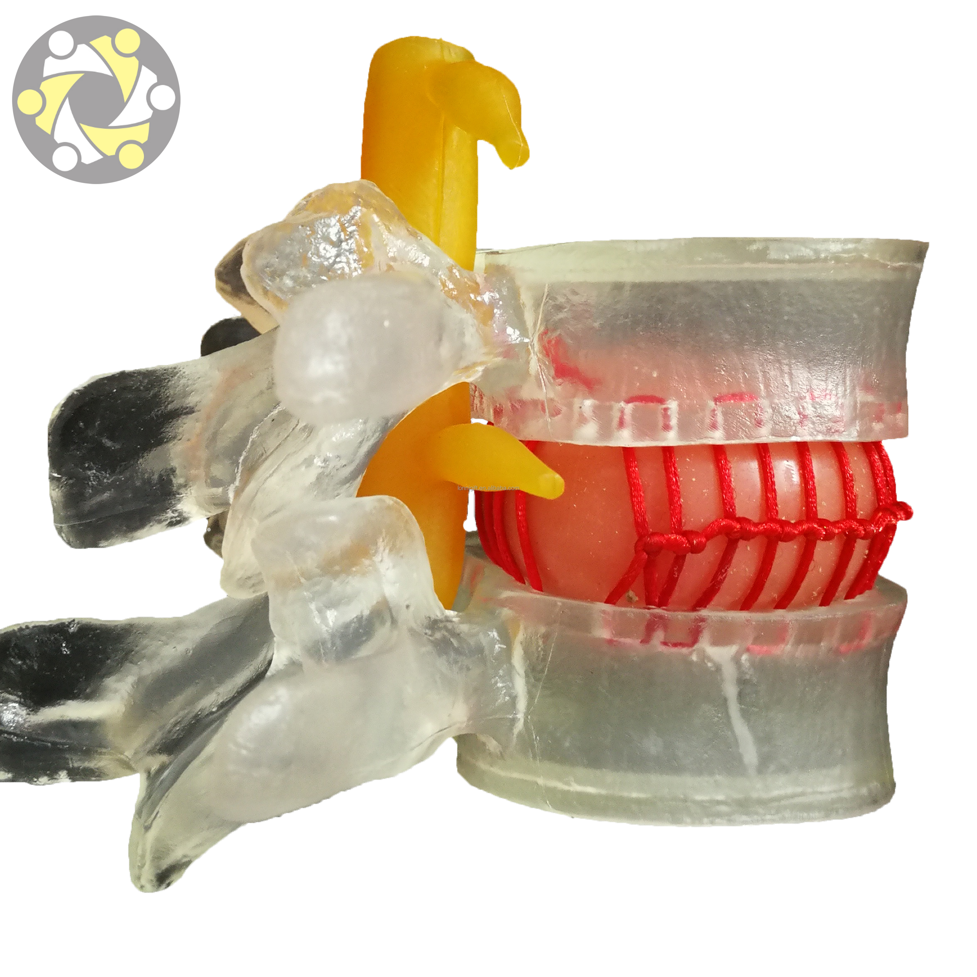 Vertebral Spine Simulator For Lumbar Disc Herniation Medical Science ...