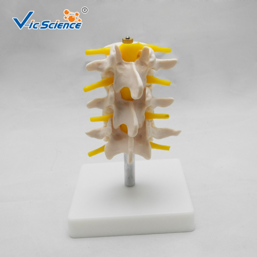 Lumbar Vertebra Anatomy Medical Model คุณภาพสูง Lumbar Vertebra Anatomy ...