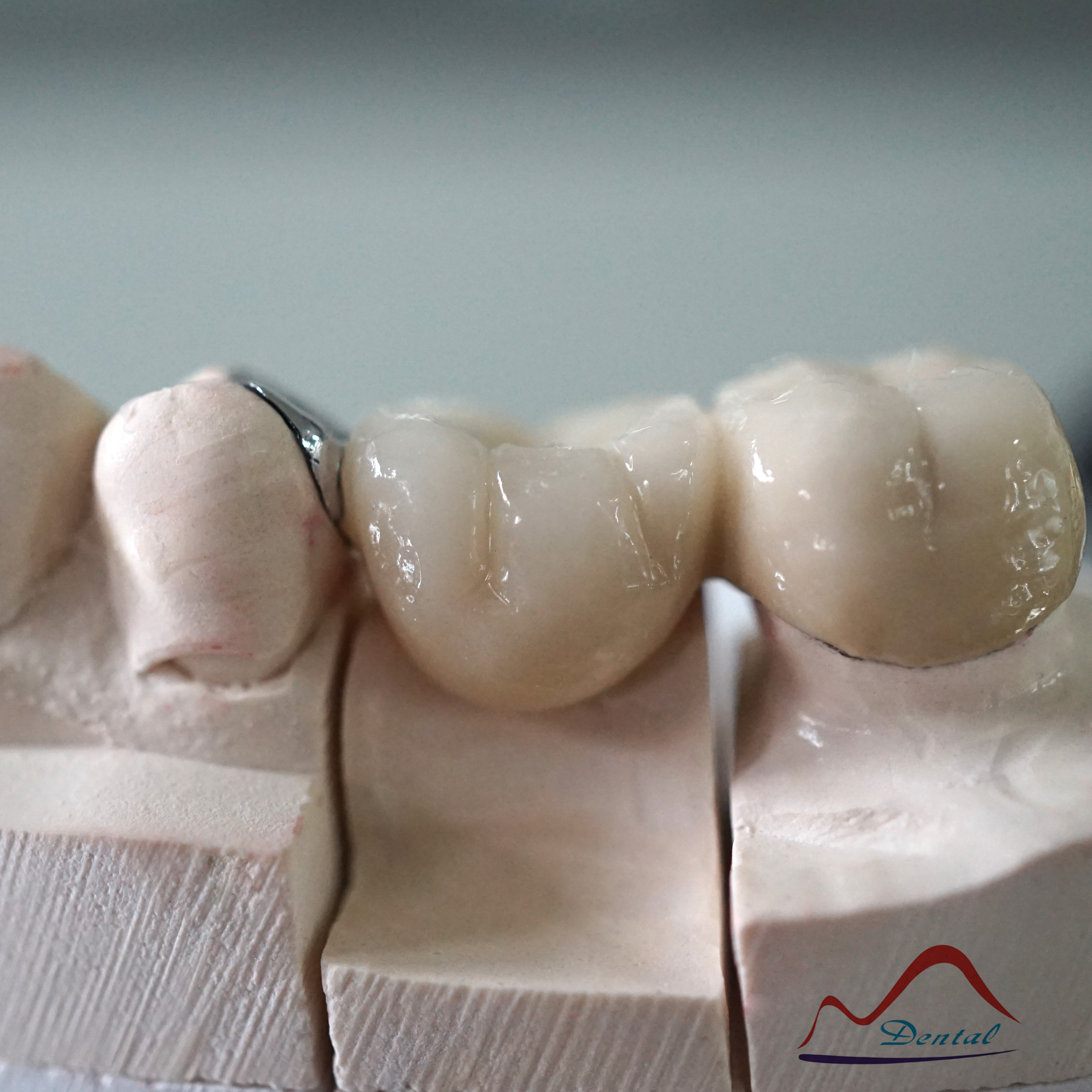 Porcelain Bridge With Rest, High Quality Porcelain Bridge With Rest on ...