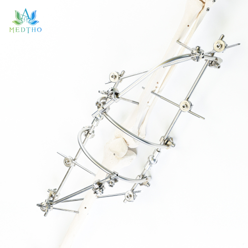 Ex Fix Knee, High Quality Ex Fix Knee on Bossgoo.com