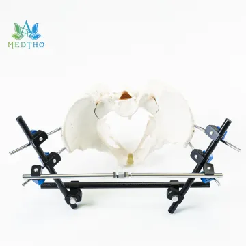 Combination Pelvic External Fixator In Orthopedic, High Quality ...