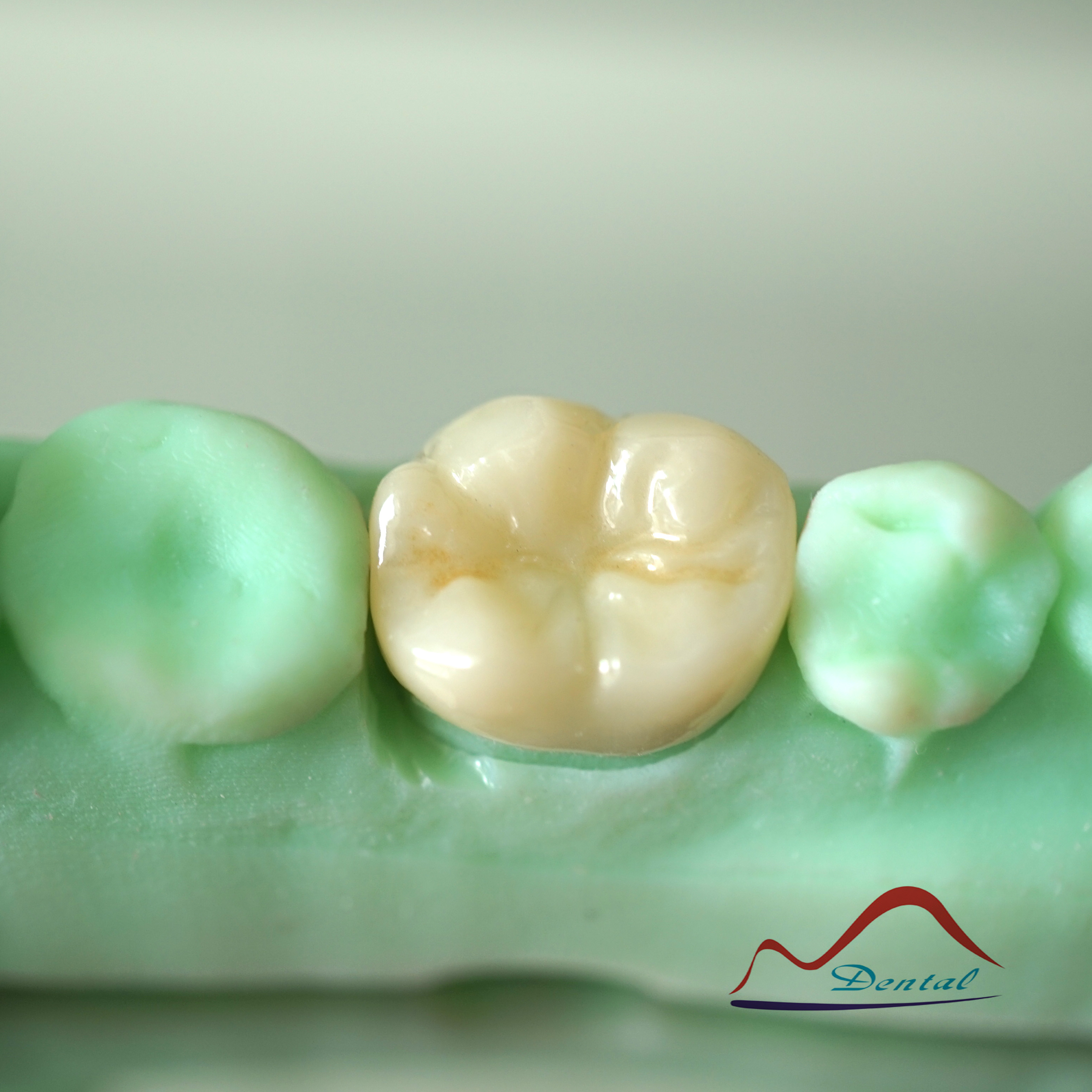 3shape Posterior Full Contour Zirconia Crown, High Quality 3shape ...