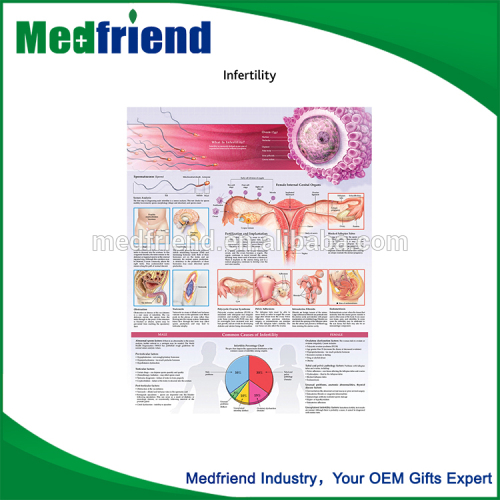3d Anatomical Chart---infertility, High Quality 3d Anatomical Chart ...