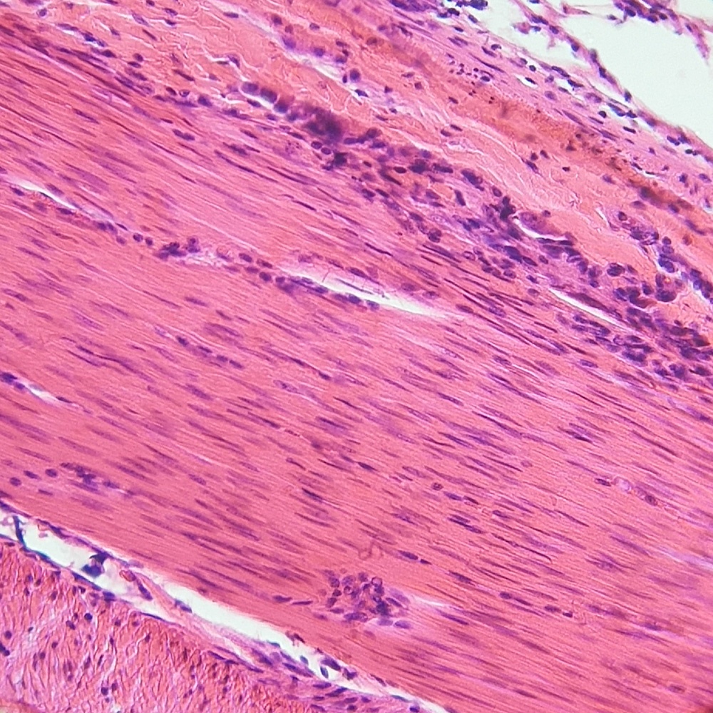 View Histology Slides: Epithelium, Muscle, Nerve, And Connective ...