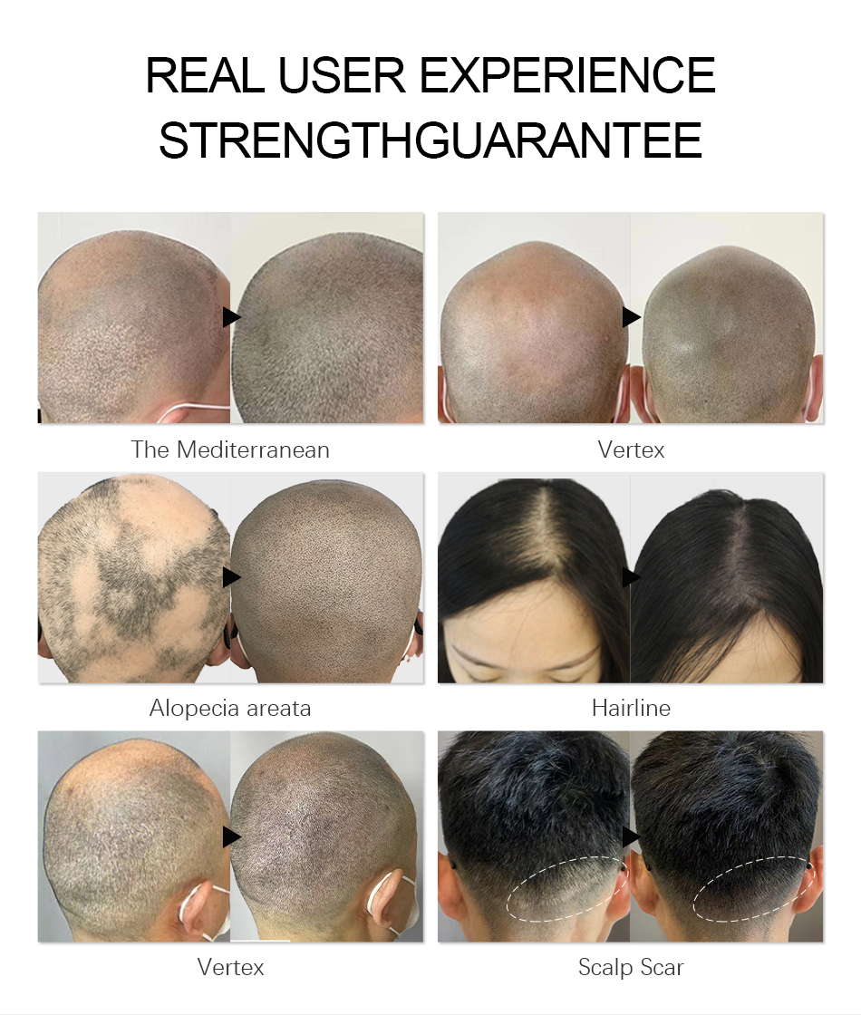 Smp Scalp Micropigmentation Pigment: New Tattoo Ink For Eyebrows, High ...