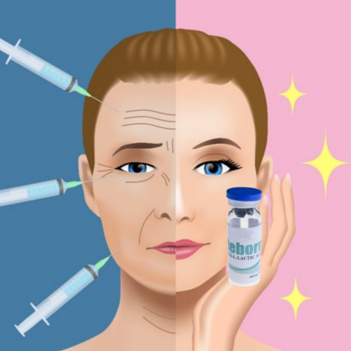 Non Surgical Neck Lift Hip Enhance Plla Fillers, High Quality Non ...