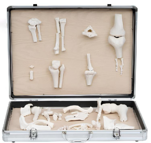 Classification Model Of Human Bone And Joint, High Quality ...