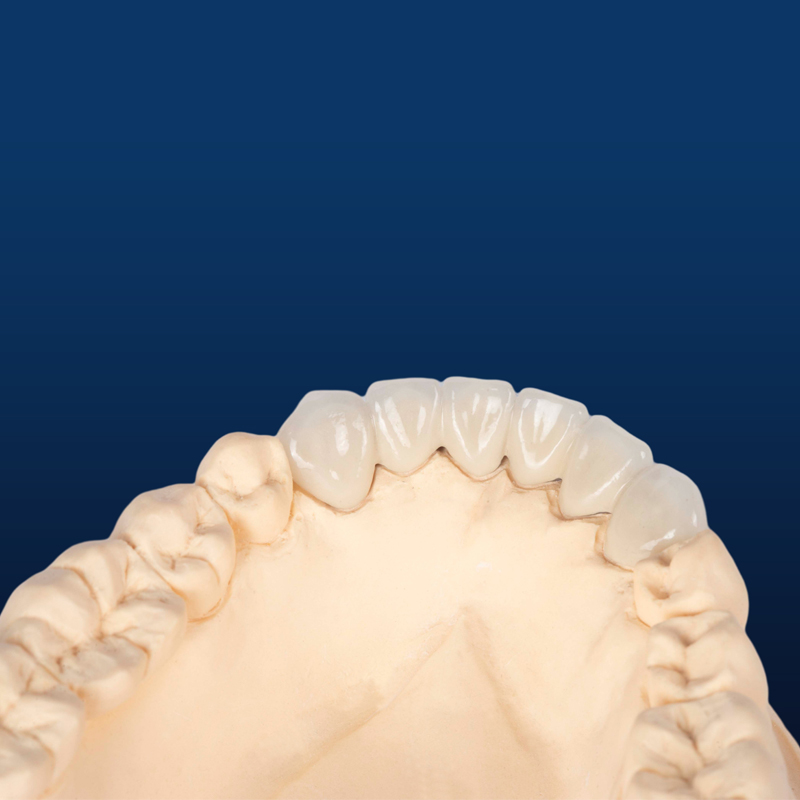 Ips Emax Cad/cam Restorations,bossgoo.comの高品質Ips Emax Cad/cam Restorations
