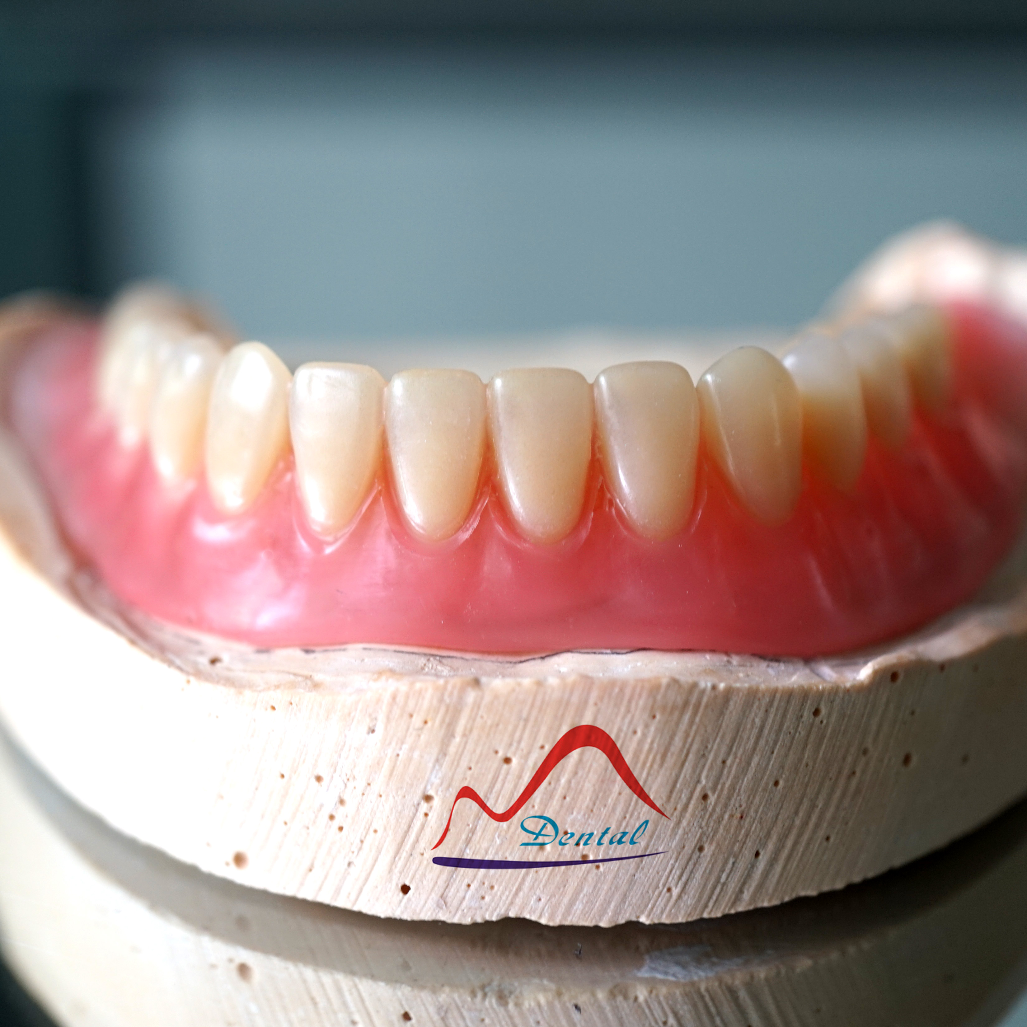 Full Denture Teeth Try In, High Quality Full Denture Teeth Try In on ...