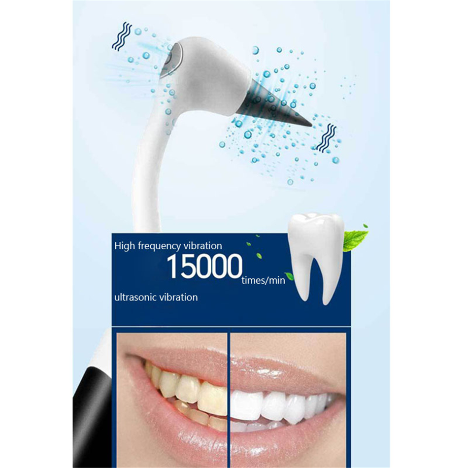 5 In 1 Electric Ultrasonic Sonic Cute Dental Scaler Tooth Calculus ...