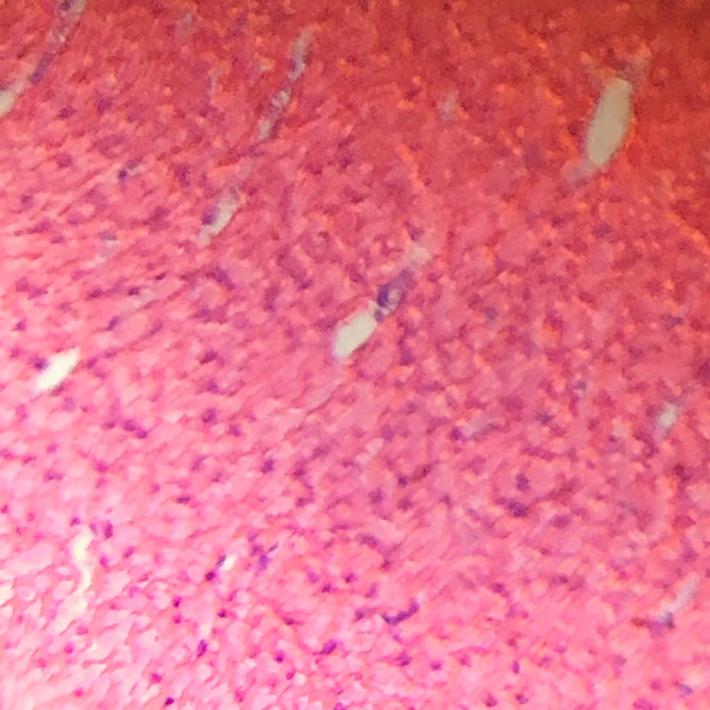 View Histology Slides: Epithelium, Muscle, Nerve, And Connective ...