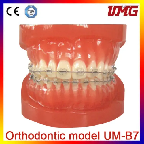Human Medical Orthodontic Dental Model, Orthodontic Model, High Quality ...