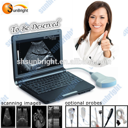 Ultrasound Scan Machine &b Mode Ultrasound Scanner China, High Quality ...