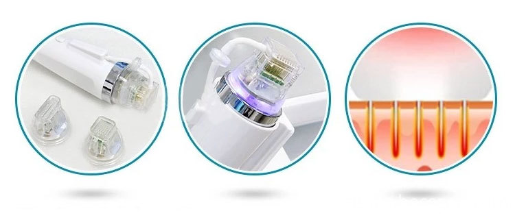 Skincare Rf Microneedling Devices For Sale, High Quality Skincare Rf ...