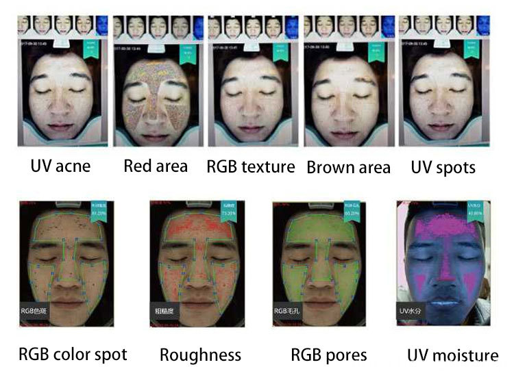 3d Facial Skin Test Analyzer Machine, High Quality 3d Facial Skin Test ...