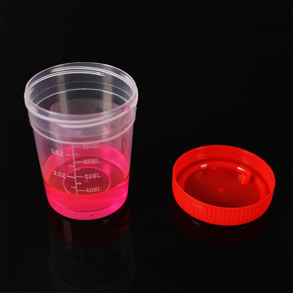 Hospital Disposable Diagnose Consumable Urine Cup, High Quality ...