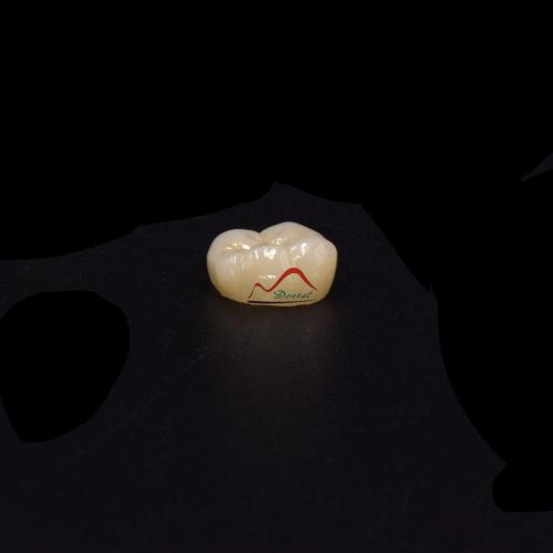 구치부 Ips E.max Press Prosthesis, Bossgoo.com의 고품질 구치부 Ips E.max Press ...