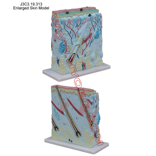 Enlarged Skin Model-j3c3.19.313, High Quality Enlarged Skin Model-j3c3 ...