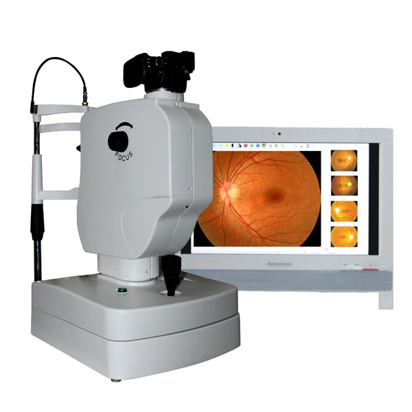 China's Best Medical Non-mydriatic And Mydriatic Retinal Camera Lk-650a ...