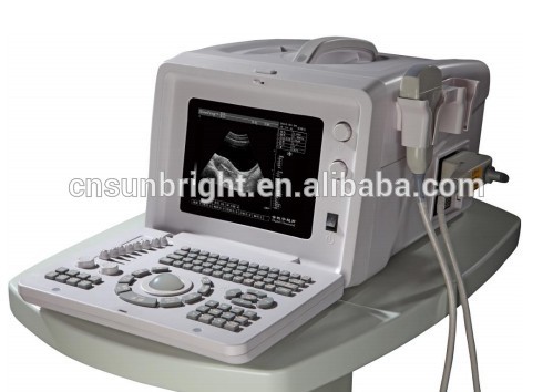 Ce/iso Certificate Approved Portable Ultrasound Scanner, High Quality ...