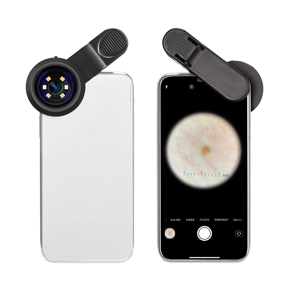 Iboolo De-300 Skin Detector: Best Mini Surgery Instrument Camera ...