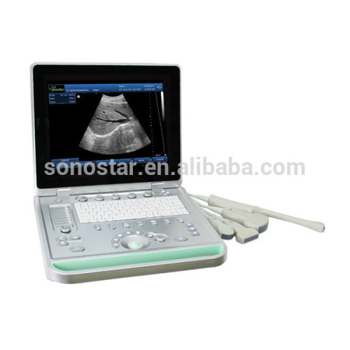 Sonostar Ultrasonic Diagnostic Devices Digital Portable Ultrasound Machine Price Ss-9, High ...