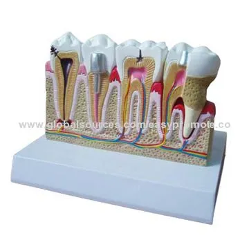 Teeth Model, Gum And Jaw Structure And Common Pathologies, High Quality ...