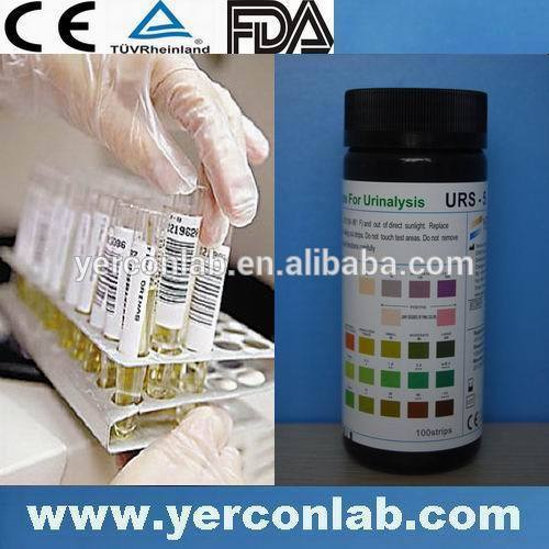 Urine Sample Analysis Urine Dipstick Analysis Fda Ce Iso, High Quality ...
