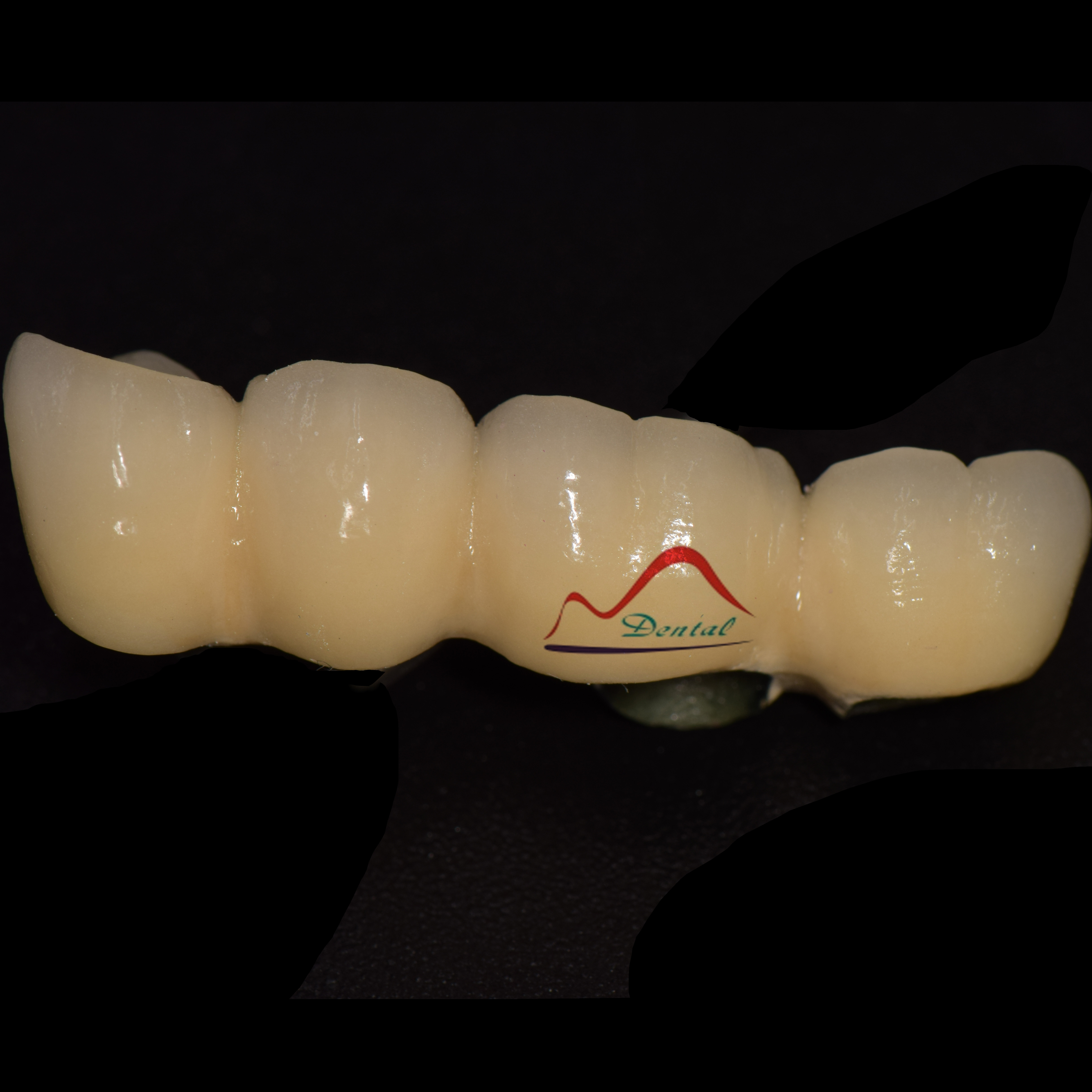 สะพานเทียมทันตกรรม Pfm คุณภาพสูง สะพานเทียมทันตกรรม Pfm บน bossgoo.com