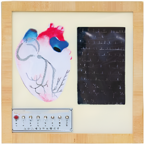 Cardiac Conduction Model, High Quality Cardiac Conduction Model on ...