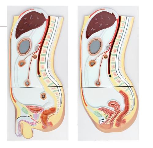 Peritoneal Sagittal, High Quality Peritoneal Sagittal on Bossgoo.com