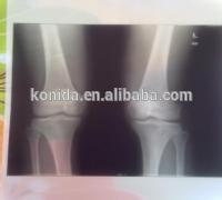 Cr System Digital X Ray Machine Price, High Quality Cr System Digital X ...