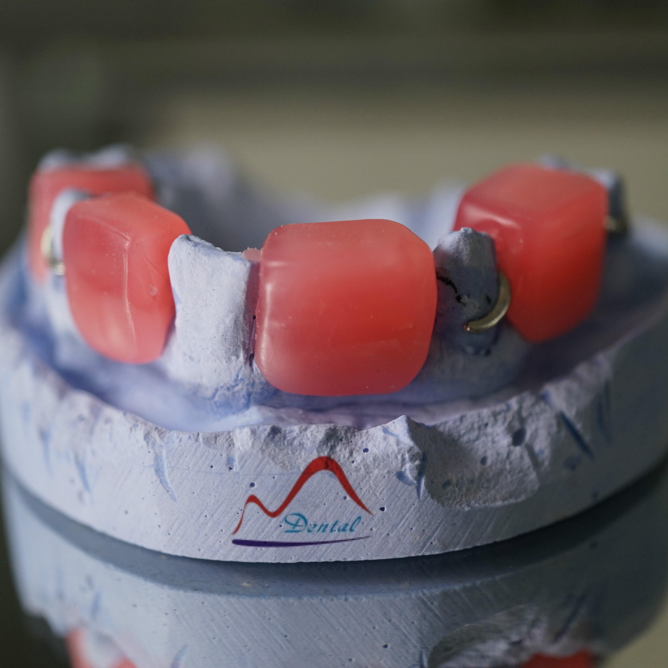 Fix Metal Framework With Wax On, High Quality Fix Metal Framework With ...