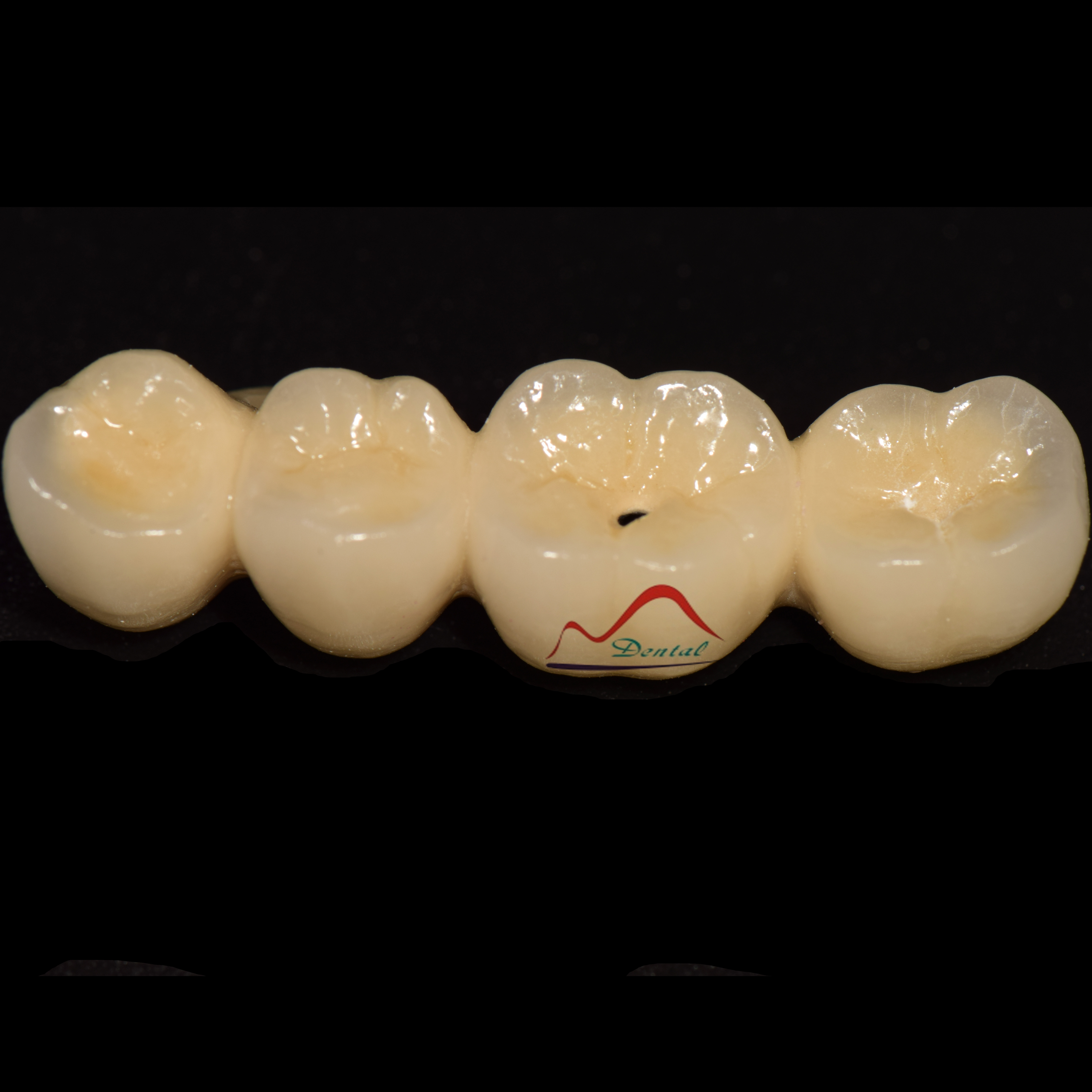 สะพานเทียมทันตกรรม Pfm คุณภาพสูง สะพานเทียมทันตกรรม Pfm บน bossgoo.com