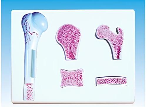 Structural Model Of Bone, High Quality Structural Model Of Bone on ...