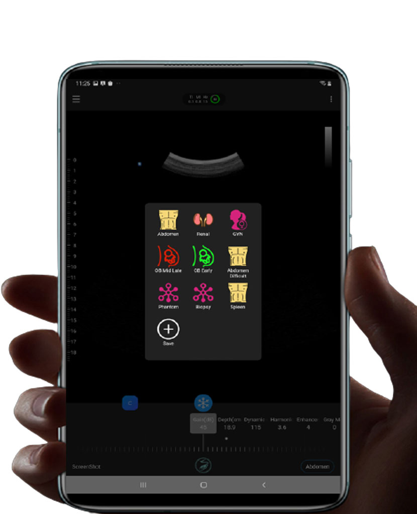 Common Types Of Ultrasonic Probes, High Quality Common Types Of ...