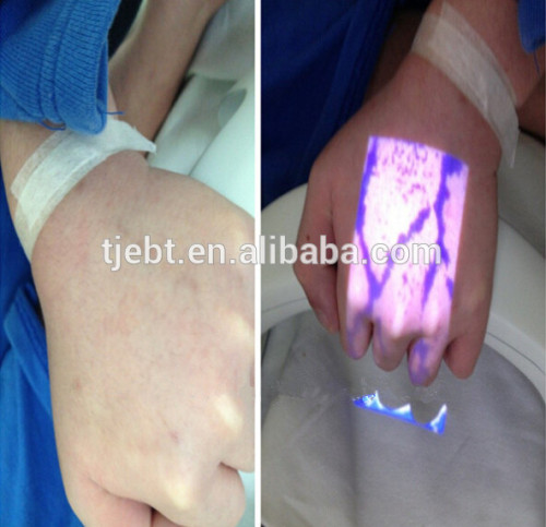 Vein Visual Instrument Vein Finder, High Quality Vein Visual Instrument ...