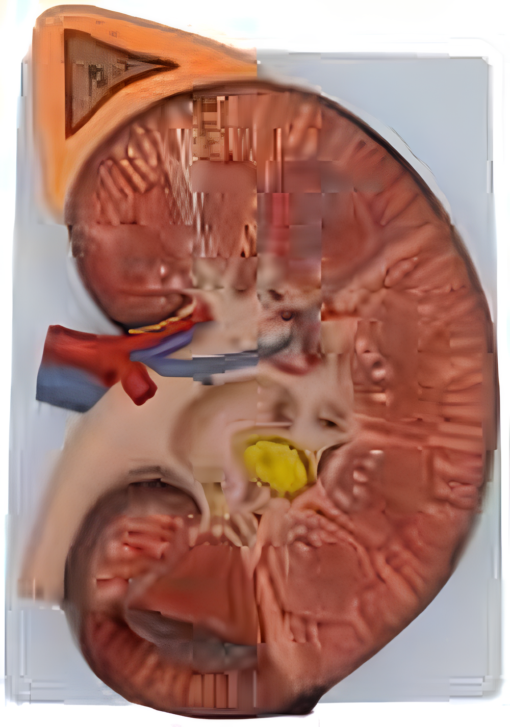 Modelo De Anatomía Renal Ampliada, alta calidad Modelo De Anatomía ...