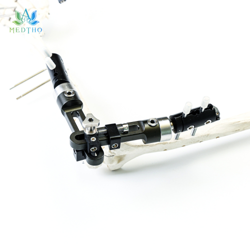 Elbow External Fixator, High Quality Elbow External Fixator on Bossgoo.com