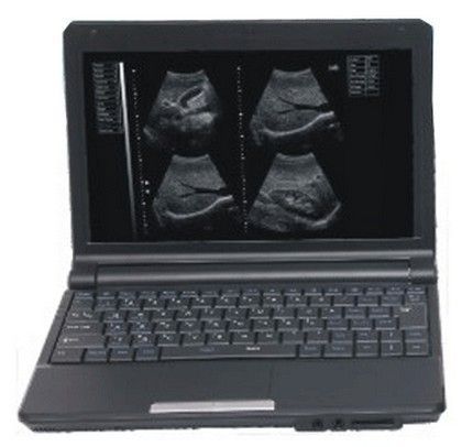 Laptop Diagnostic Ultrasound System With High-resolution, High Quality ...