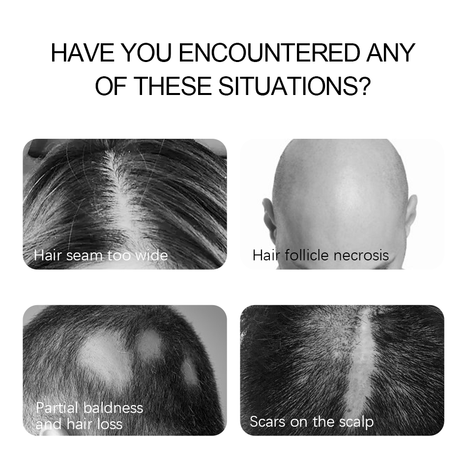 Smp Scalp Micropigmentation Pigment: New Tattoo Ink For Eyebrows, High ...